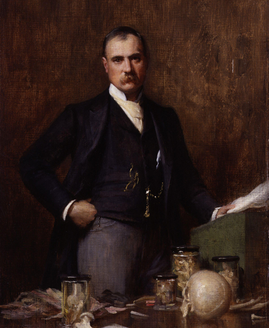 Hastalığı Ölümünden Yüz Yıl Sonra Saptanan Joseph Merrick'in Üzücü ...