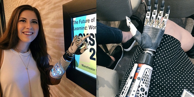 Telefon Şarjları Yüzünden Biyonik Kolunu Şarj Edemeyen Oyuncu Angel ...