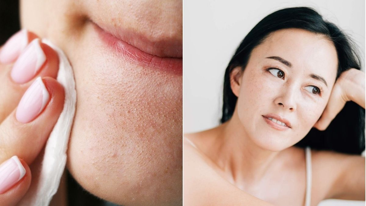 Yeni Cilt Bakım Trendi Fiddy Metodu Nedir? | ListeList.com